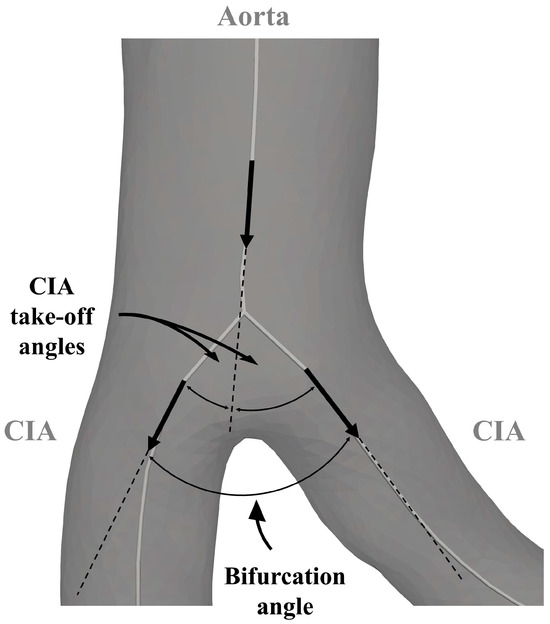 Effect of Sex, Age, and Cardiovascular Risk Factors on Aortoiliac ...