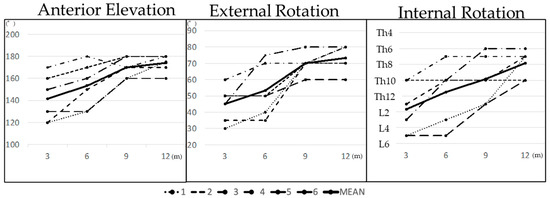 JCM | Free Full-Text | Arthroscopically Assisted Coracoclavicular (CC ...