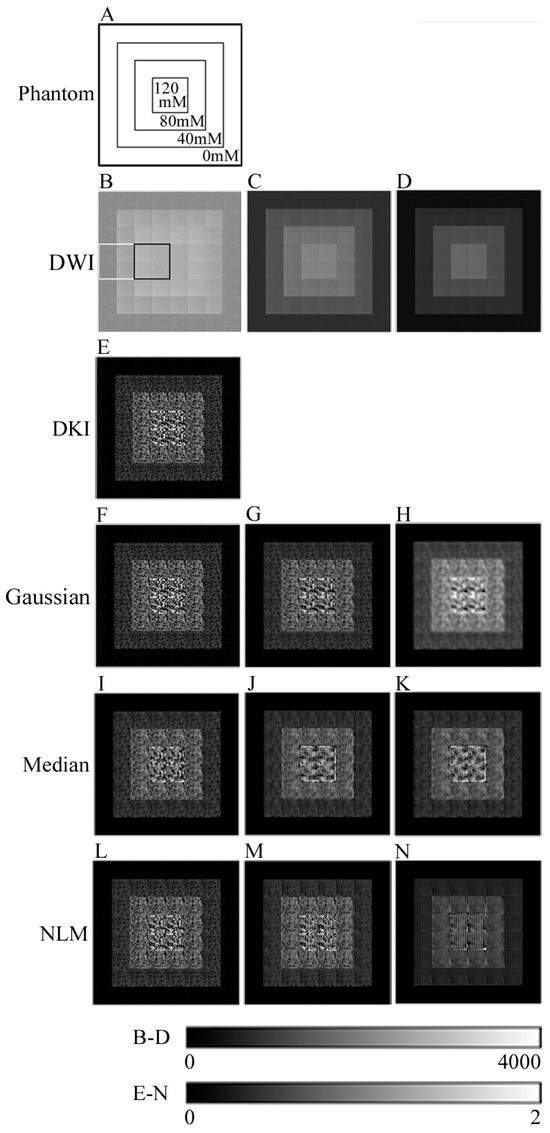 JCM | Free Full-Text | Enhancing Diagnostic Precision: Evaluation of Preprocessing Filters in ...