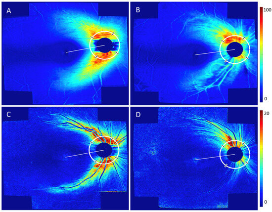 Current Status and Future Perspectives of Optic Nerve Imaging in Glaucoma