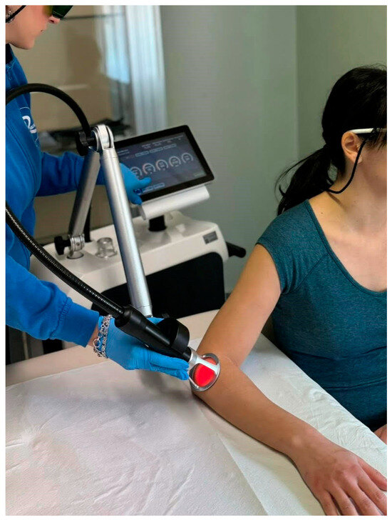 JCM | Free Full-Text | Effectiveness of High-Power Laser Therapy via ...