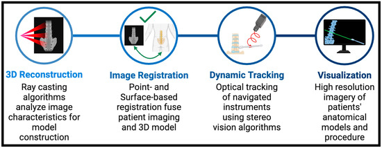 Image-Guided Navigation in Spine Surgery: From Historical Developments ...
