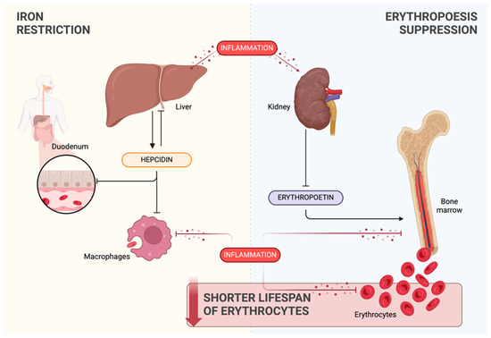 Anemia and Its Connections to Inflammation in Older Adults: A Review