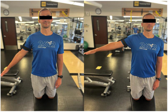 JCM | Free Full-Text | Shoulder Proprioception: A Review