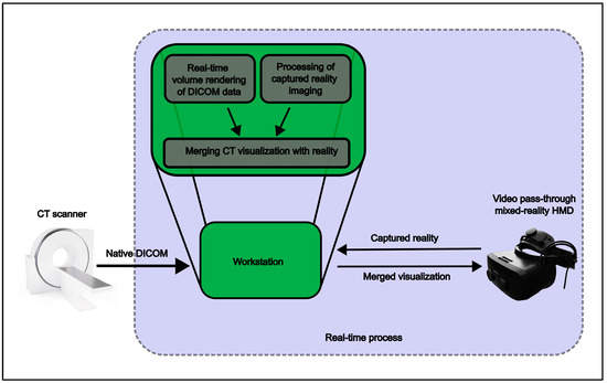 A System for Mixed-Reality Holographic Overlays of Real-Time Rendered ...