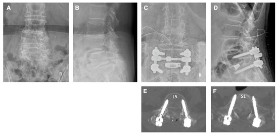 Jcm Free Full Text A Novel Intraoperative Ct Navigation System For