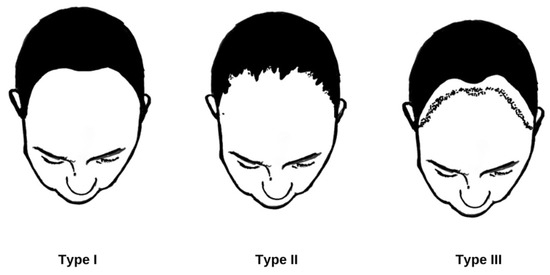 The Frontal Fibrosing Alopecia Treatment Dilemma