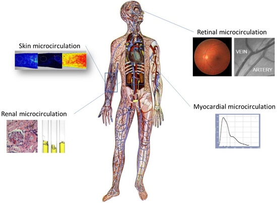 Accumulation of Microvascular Target Organ Damage in Systemic Lupus ...