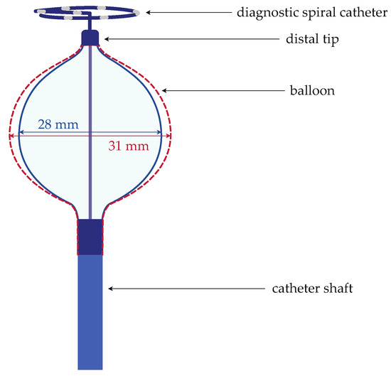 Pulmonary Vein Isolation with a Novel Size-Adjustable Cryo-Balloon ...