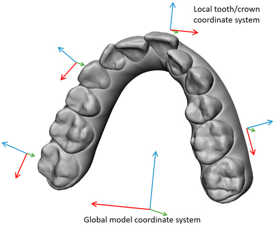 Accuracy of Digital Orthodontic Treatment Planning: Assessing Aligner ...