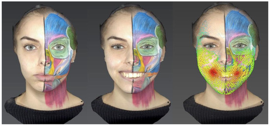Facial Painting and 3D Stereophotogrammetric Analysis of Facial ...