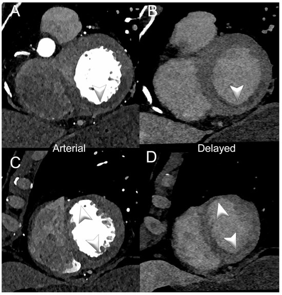 Spectral Photon-Counting Computed Tomography: Technical Principles and ...