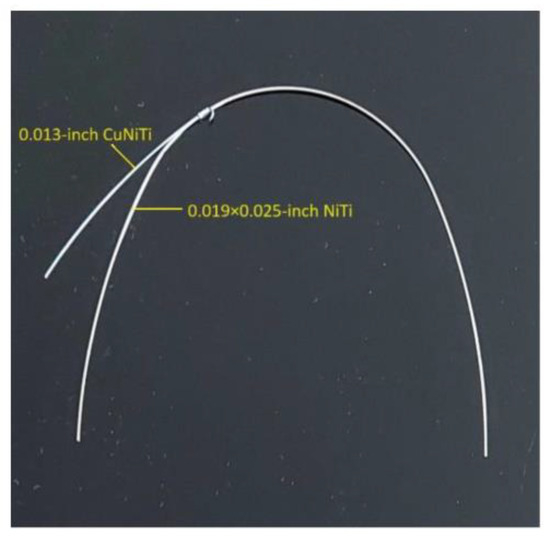 Comparisons of Two Different Treatment Methods for Impacted Maxillary ...