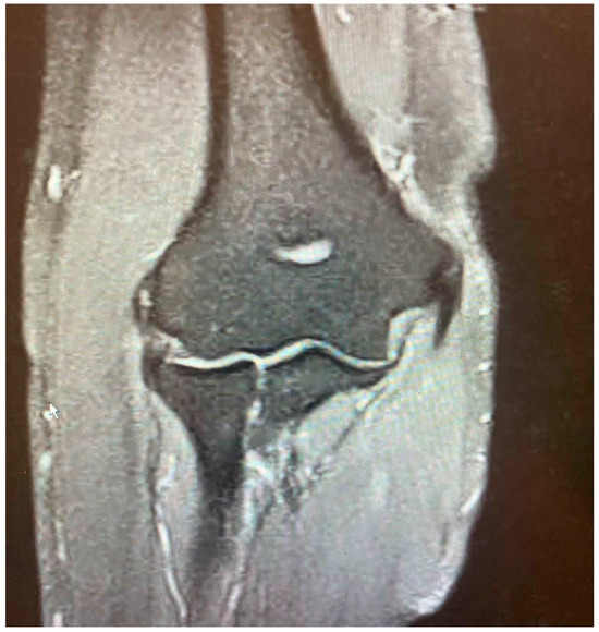A Novel Surgical Treatment Management Algorithm for Elbow ...