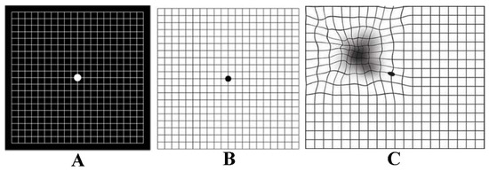 Visual Field Tests: A Narrative Review of Different Perimetric Methods
