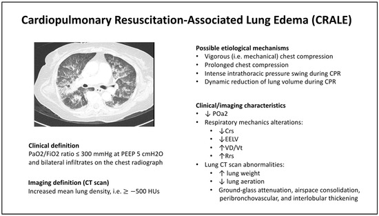 Acute Lung Injury after Cardiopulmonary Resuscitation: A Narrative Review