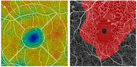An OCT-A Analysis of the Importance of Intermediate Capillary Plexus in ...