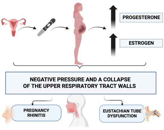 Objective Measurements of Nasal Obstruction and Eustachian Tube ...