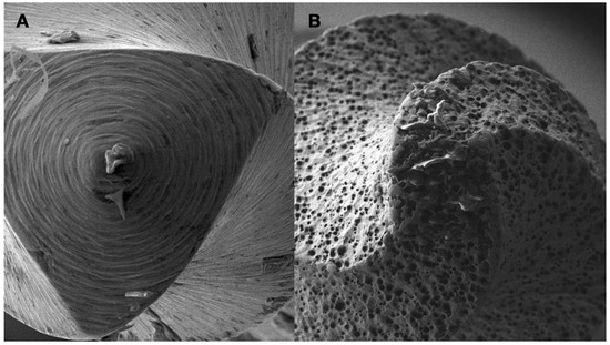 Negotiation of Calcified Canals