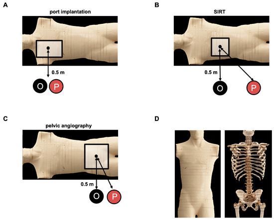 Radiation Exposure and Safety Considerations in Interventional ...