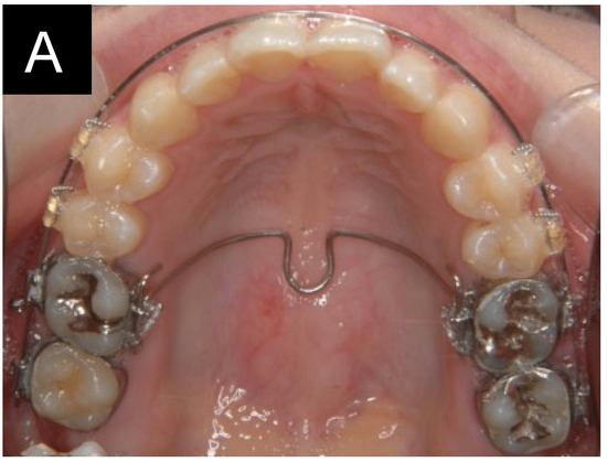 Three-Dimensional Evaluation of Treatment Effects and Post-Treatment ...