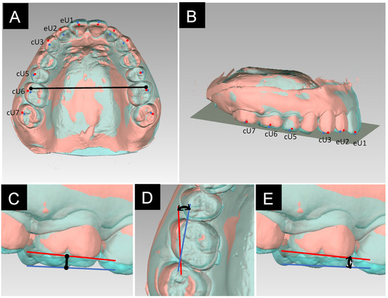 Three-Dimensional Evaluation of Treatment Effects and Post-Treatment ...