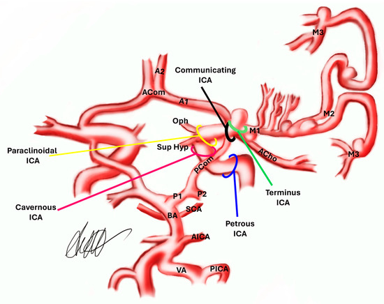 Geometry and Symmetry of Willis’ Circle and Middle Cerebral Artery ...