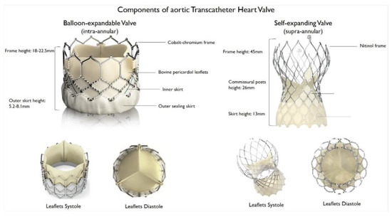 Transcatheter Aortic Valve Implantation for Severe Chronic Aortic ...