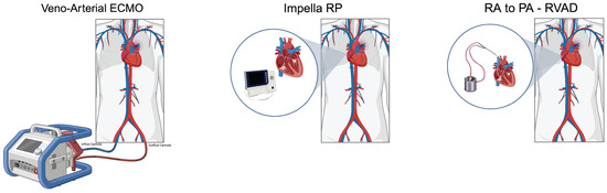 Mechanical Circulatory Support Devices in Patients with High-Risk ...
