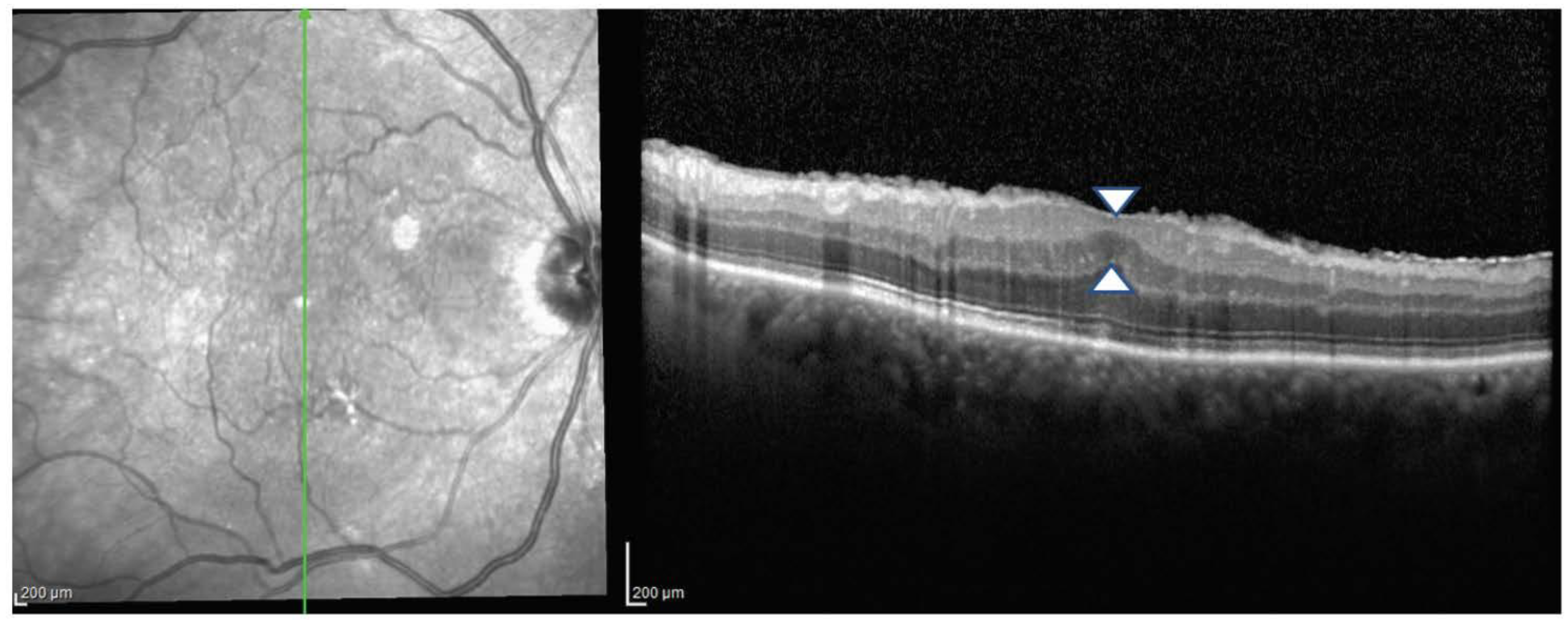 Comparison of Functional, Structural, and Microvascular Features in ...