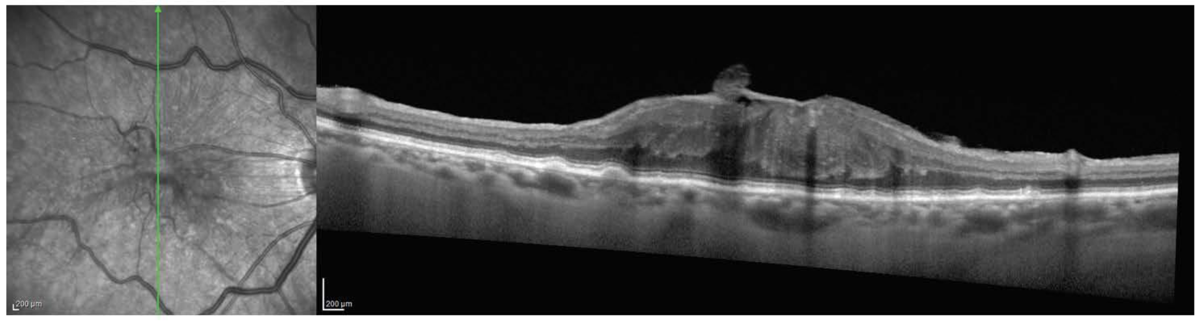 Comparison of Functional, Structural, and Microvascular Features in ...