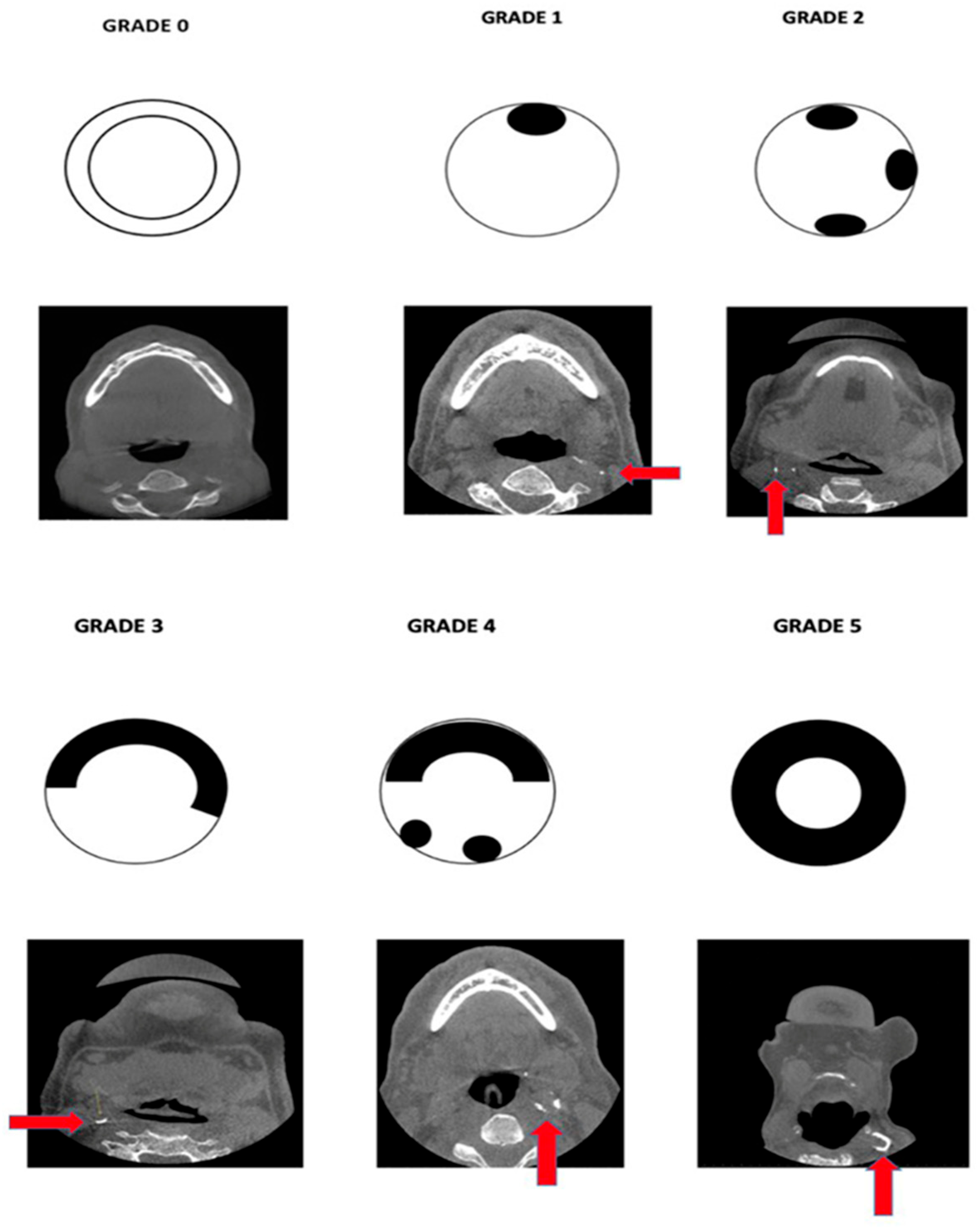 JCM | Free Full-Text | Evaluation of Cone-Beam Computed Tomography ...