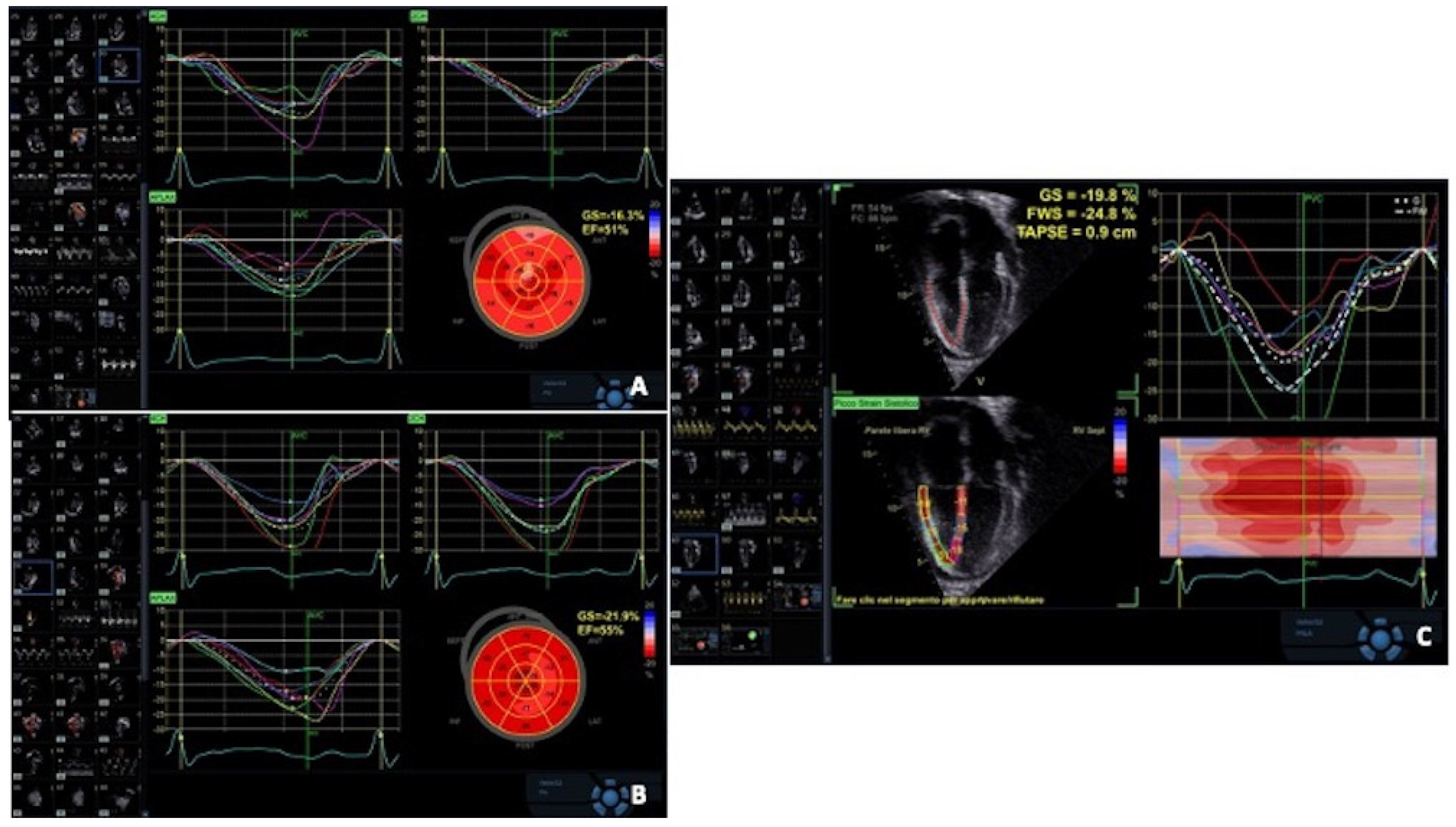 A Comprehensive Excursus of the Roles of Echocardiography in Heart ...