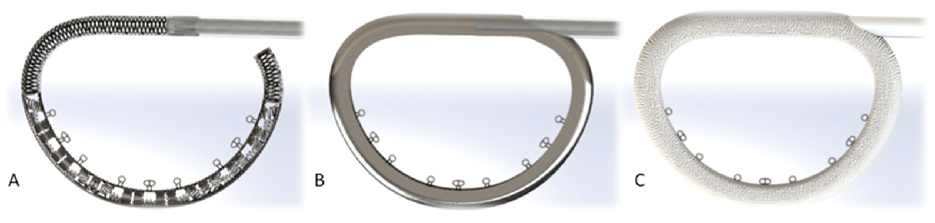 First-in-Man Study of a Novel, Balloon-Adjustable Mitral Annuloplasty Ring