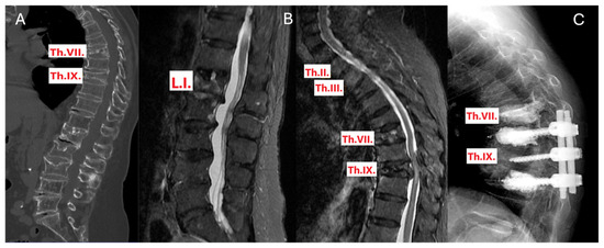 From Detection to Decision: How STIR Sequence MRI Influences Treatment ...