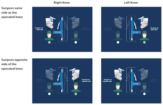Analysis of the Initial Learning Curve for Robotic-Assisted Total Knee ...
