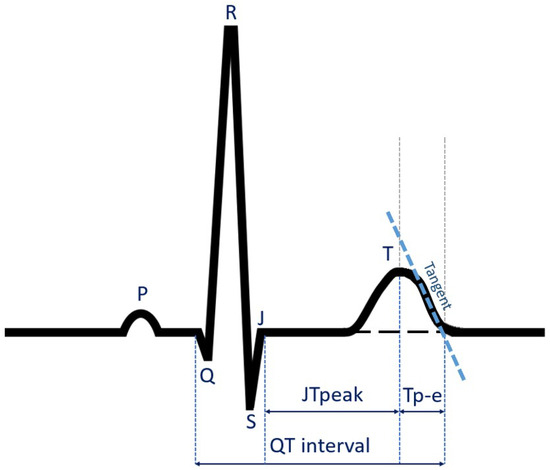 The Effect of Obesity on Repolarization and Other ECG Parameters