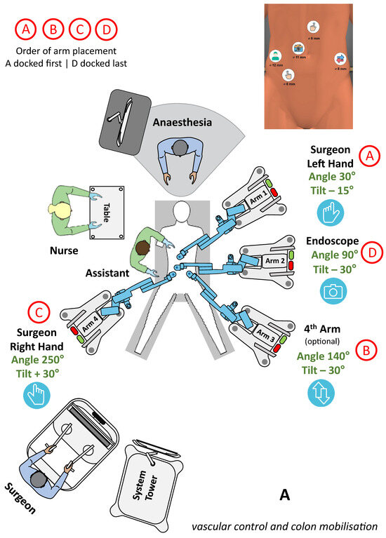 JCM | Free Full-Text | Use of HugoTM RAS in General Surgery: The First ...