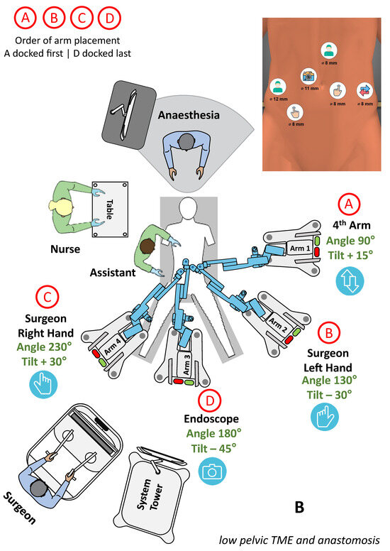 JCM | Free Full-Text | Use of HugoTM RAS in General Surgery: The First ...