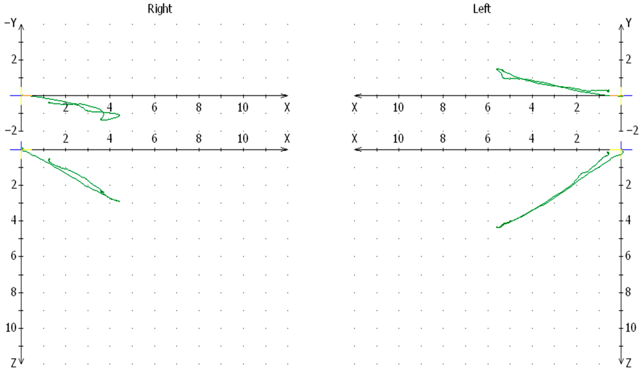 Influence of Method of Treatment of Mandibular Condylar Fractures on ...