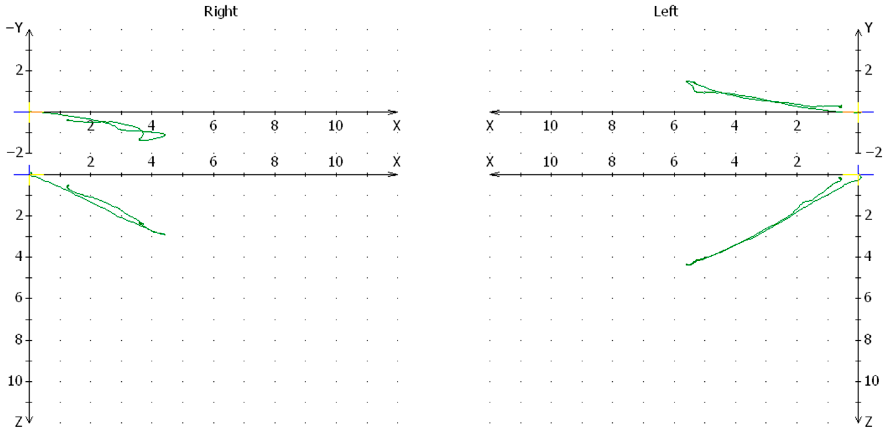 Influence of Method of Treatment of Mandibular Condylar Fractures on ...