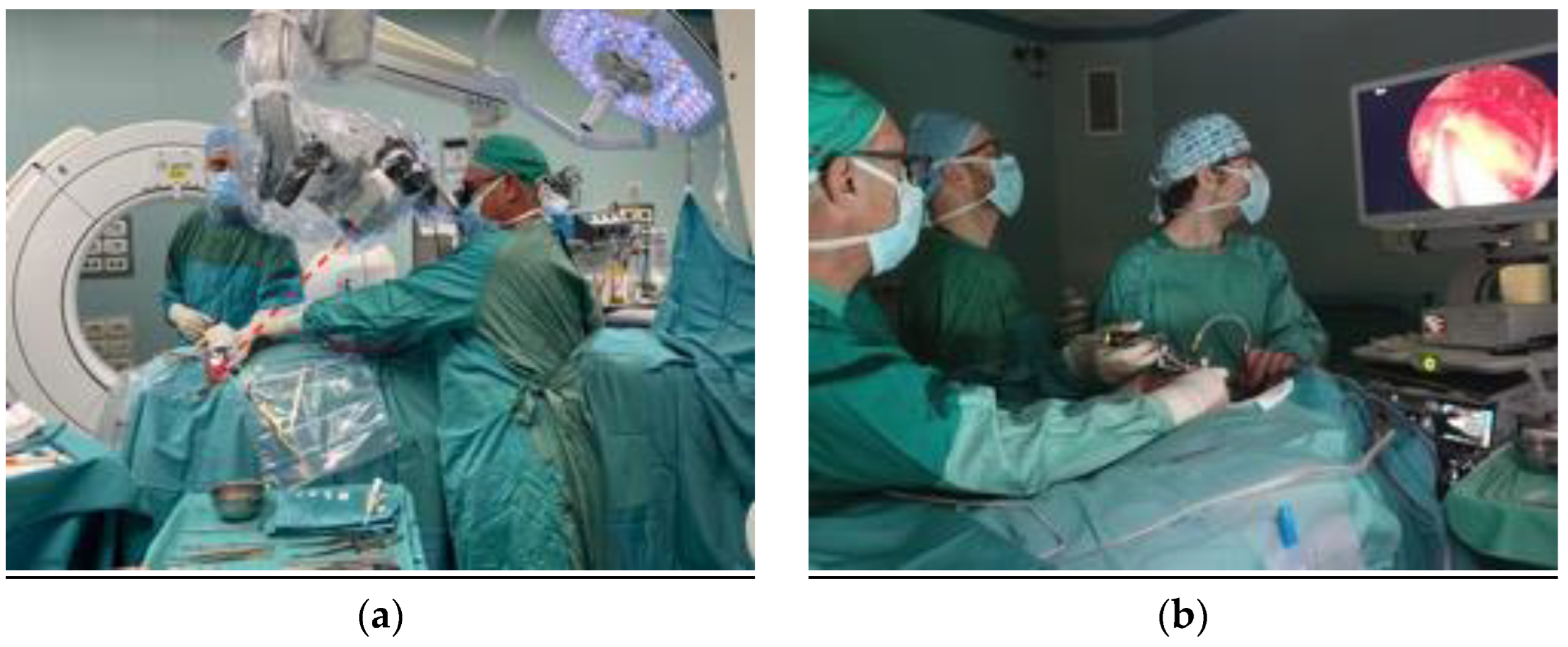 A Three-Step Submandibular Retropharyngeal Approach to the ...