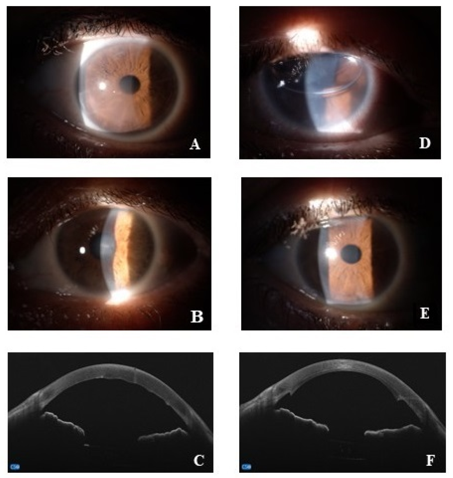 JCM | Free Full-Text | Expression of Hormones’ Receptors in Human ...