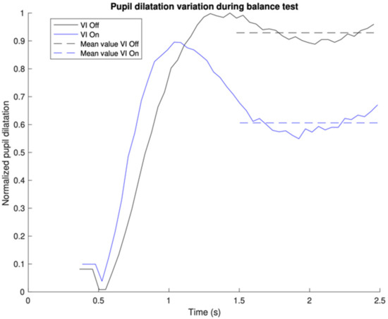 Using Pupillometry to Evaluate Balance in Patients Implanted with a ...