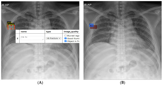 Development and Validation of an Artificial Intelligence Model for ...