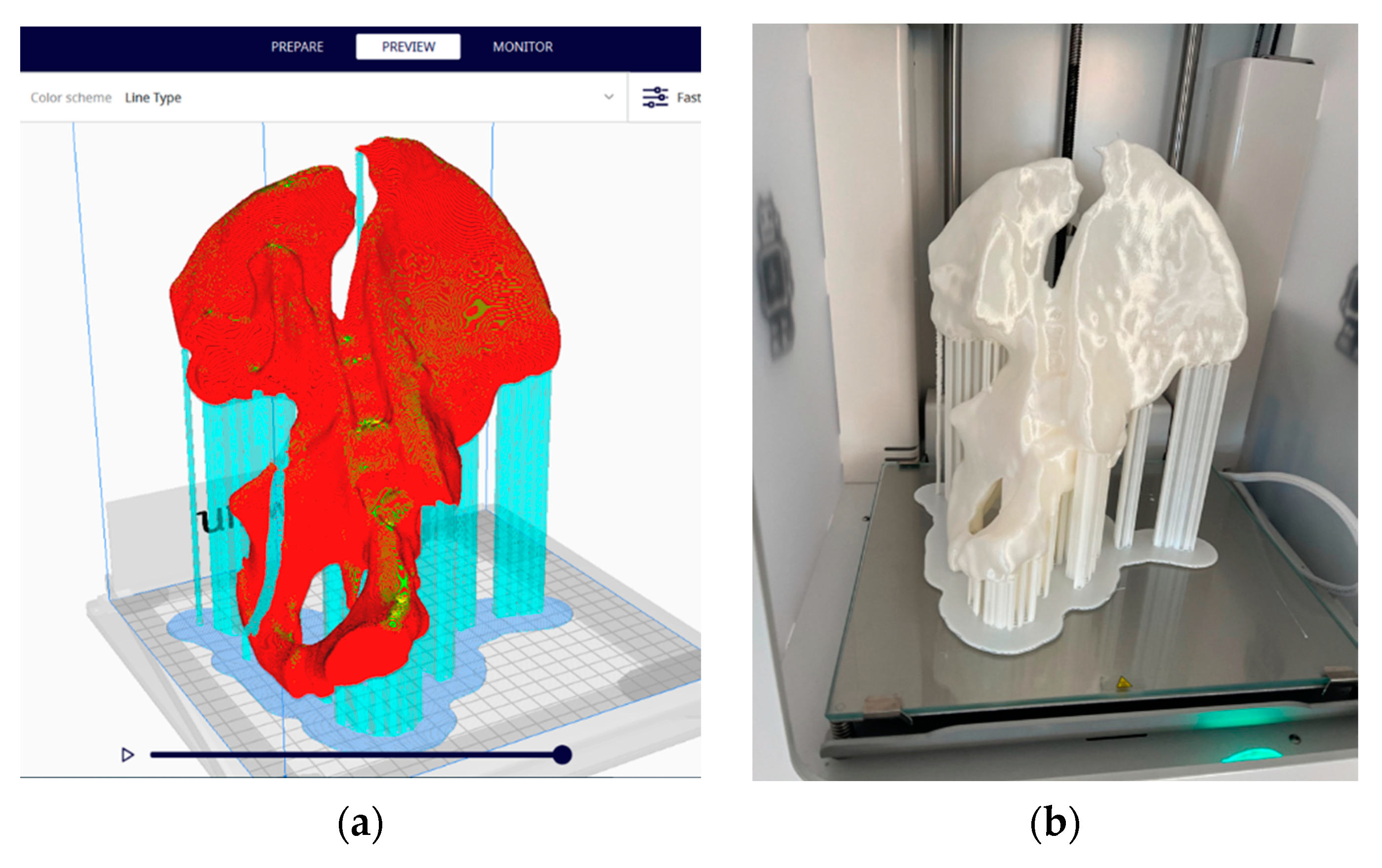 JCM | Free Full-Text | Clinical Workflow Algorithm for Preoperative ...