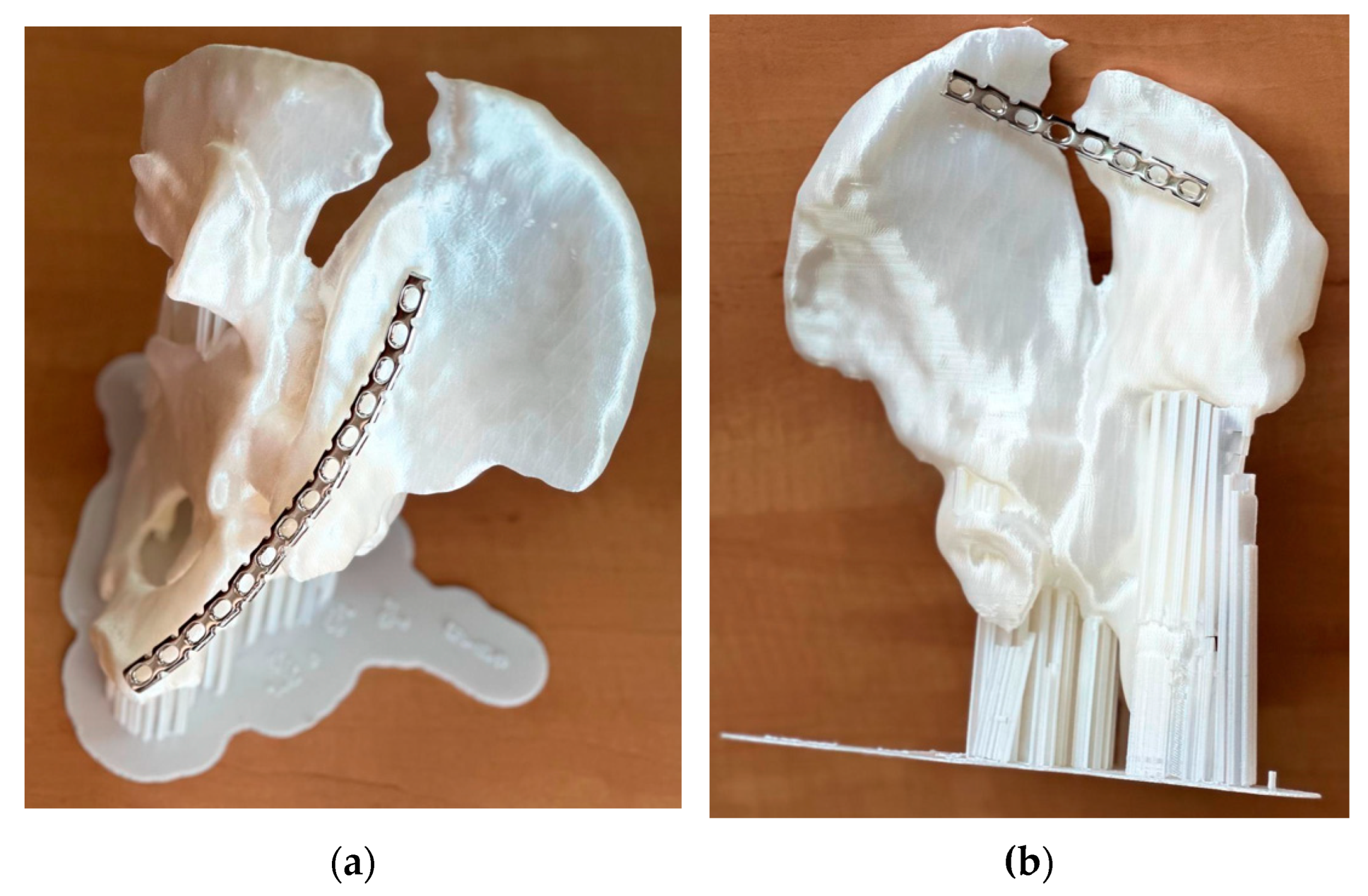 JCM | Free Full-Text | Clinical Workflow Algorithm for Preoperative ...