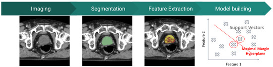 Radiomic Pipelines for Prostate Cancer in External Beam Radiation ...