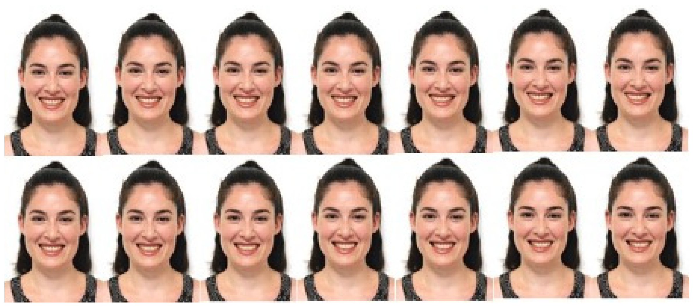 Impact of Dental Midline Shift on the Perception of Facial ...