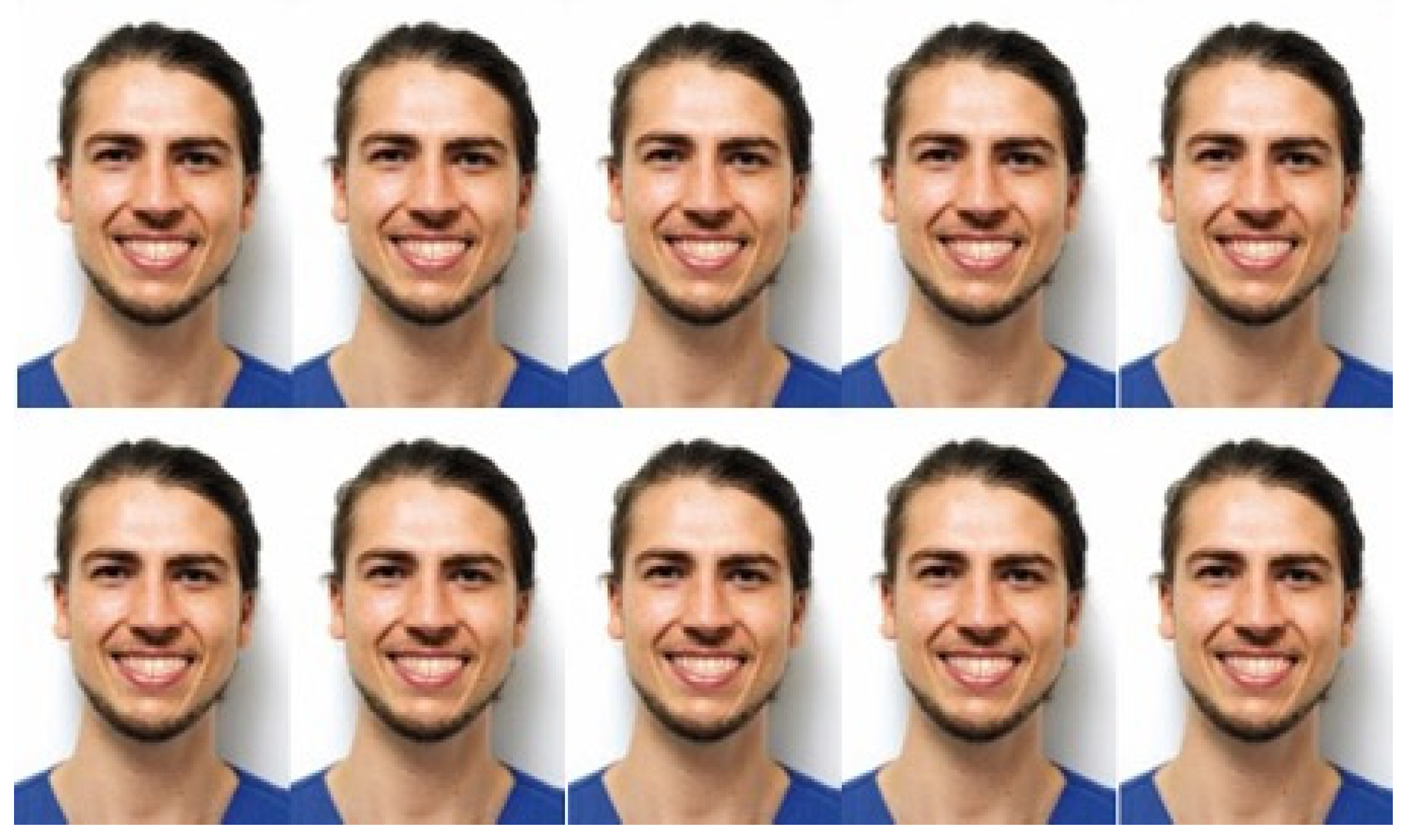 Impact of Dental Midline Shift on the Perception of Facial ...